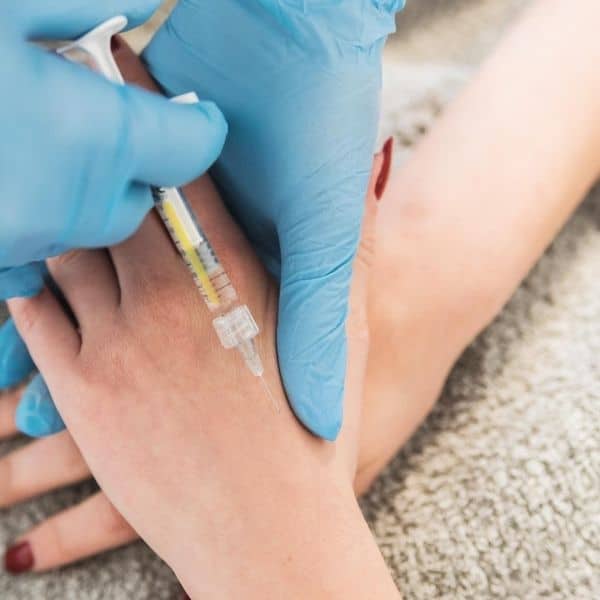 Hand Fillers in Barnet & Marylebone | Surgicare Aesthetics